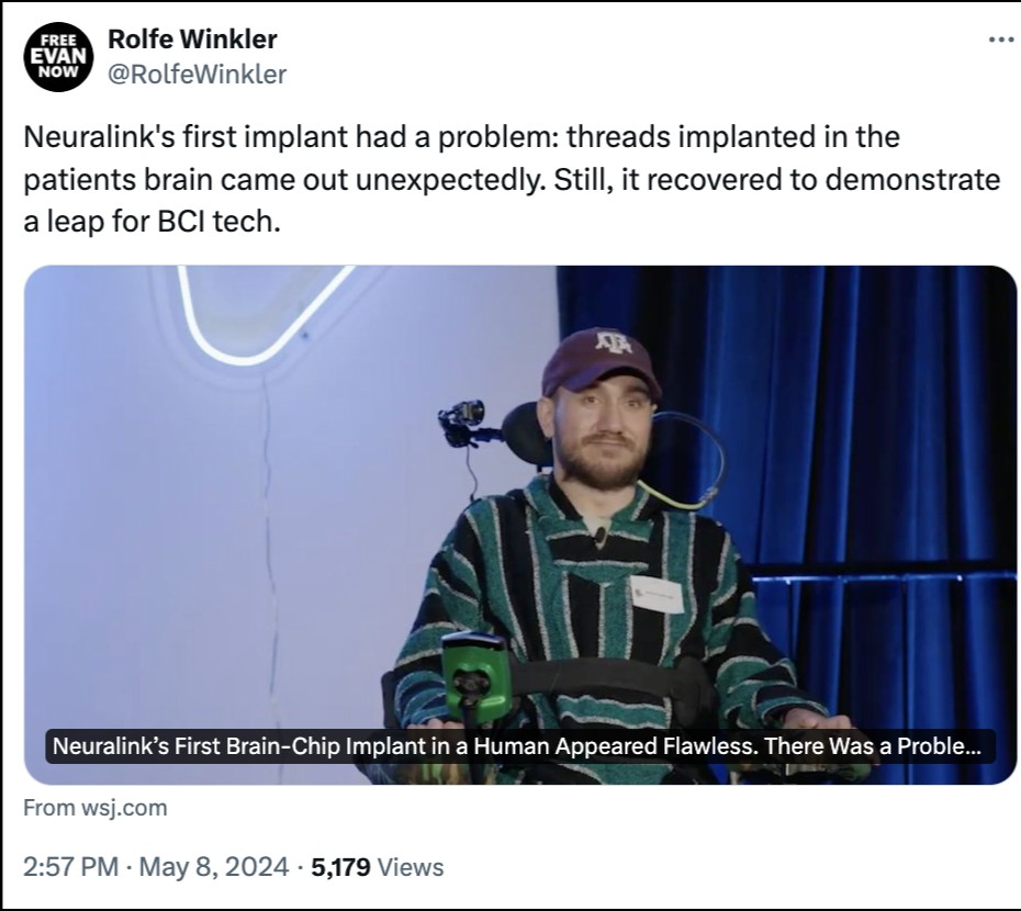 Neuralink Co-Founder Quits, Warns of Safety Failures Such as Brain ...